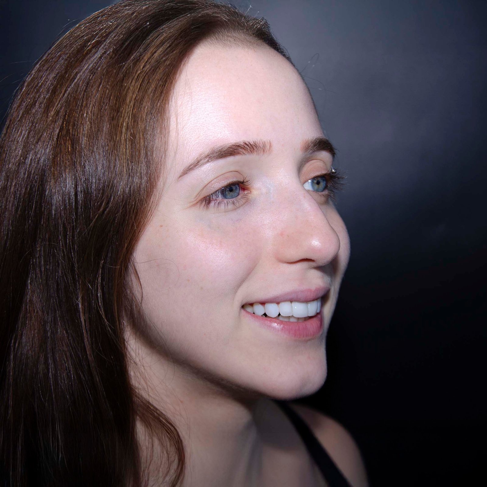 Próteses removíveis (Dentadura e Roach) - Dra. Bruna Martins